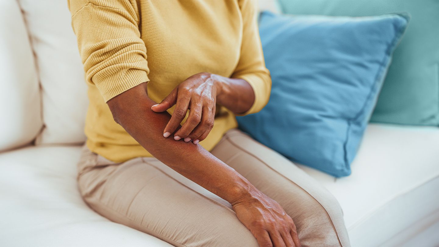 6 Skin Conditions Associated With Ulcerative Colitis