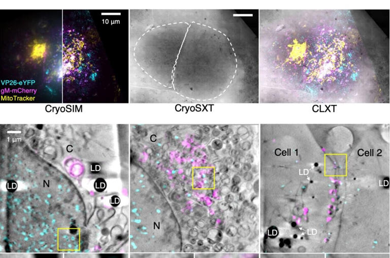 3D imaging approach reveals intricate steps of herpes simplex virus ...