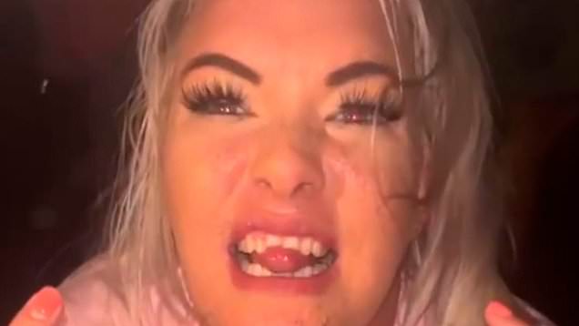 Mum pays €2000 to get teeth done after smashing teeth on a fall