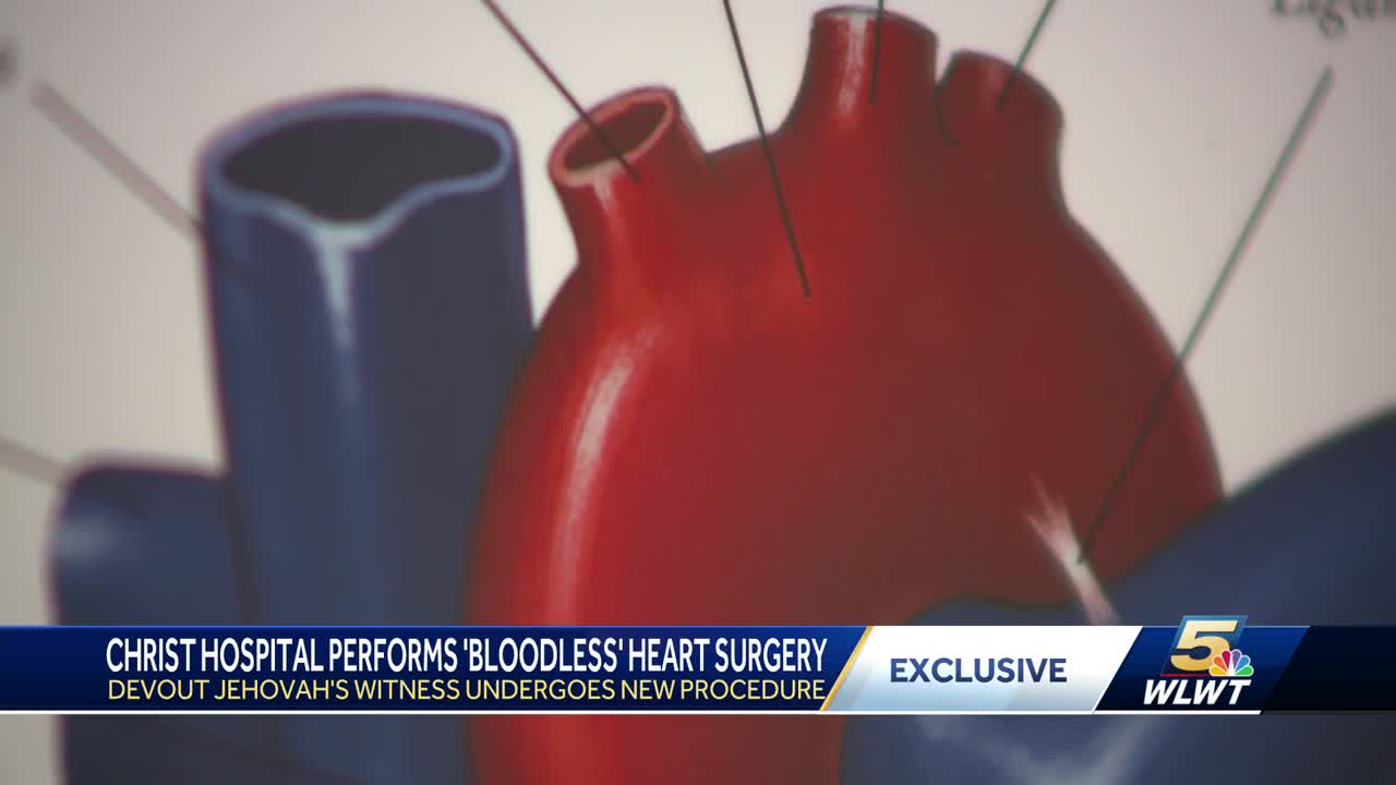 Christ Hospital performs bloodless heart surgery on devout Jehovah’s ...