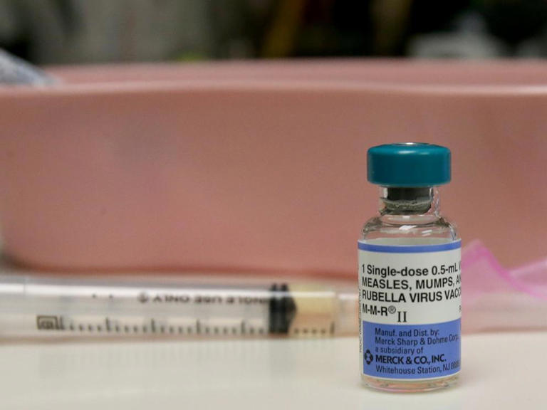 5 things to know about measles
