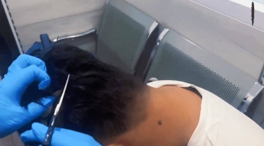 WATCH: Officers cut open man’s ‘narco wig’ at Colombian airport to ...