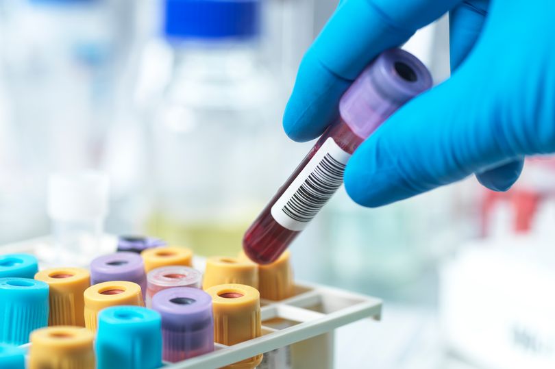 Blood test predicts cancer and 30 diseases in people who seem healthy
