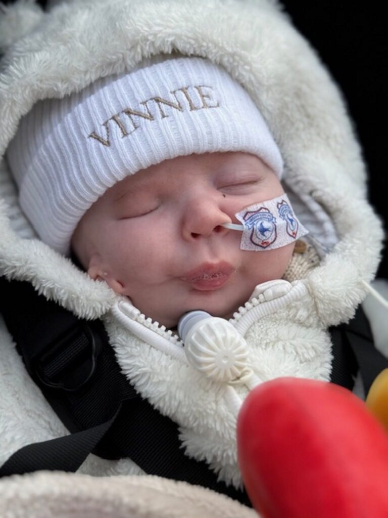 Baby born with ear on his cheek as part of rare syndrome