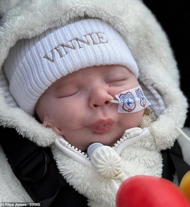 Baby born with ear on his cheek as part of rare syndrome