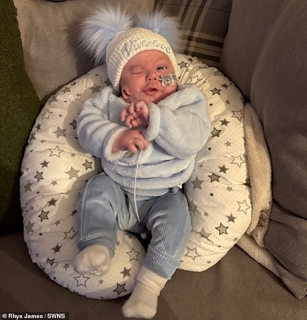 Baby born with ear on his cheek as part of rare syndrome