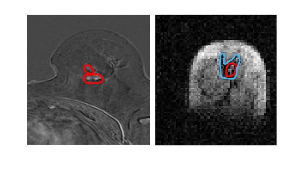 World’s first ultra-low magnetic scanner may transform cancer treatment