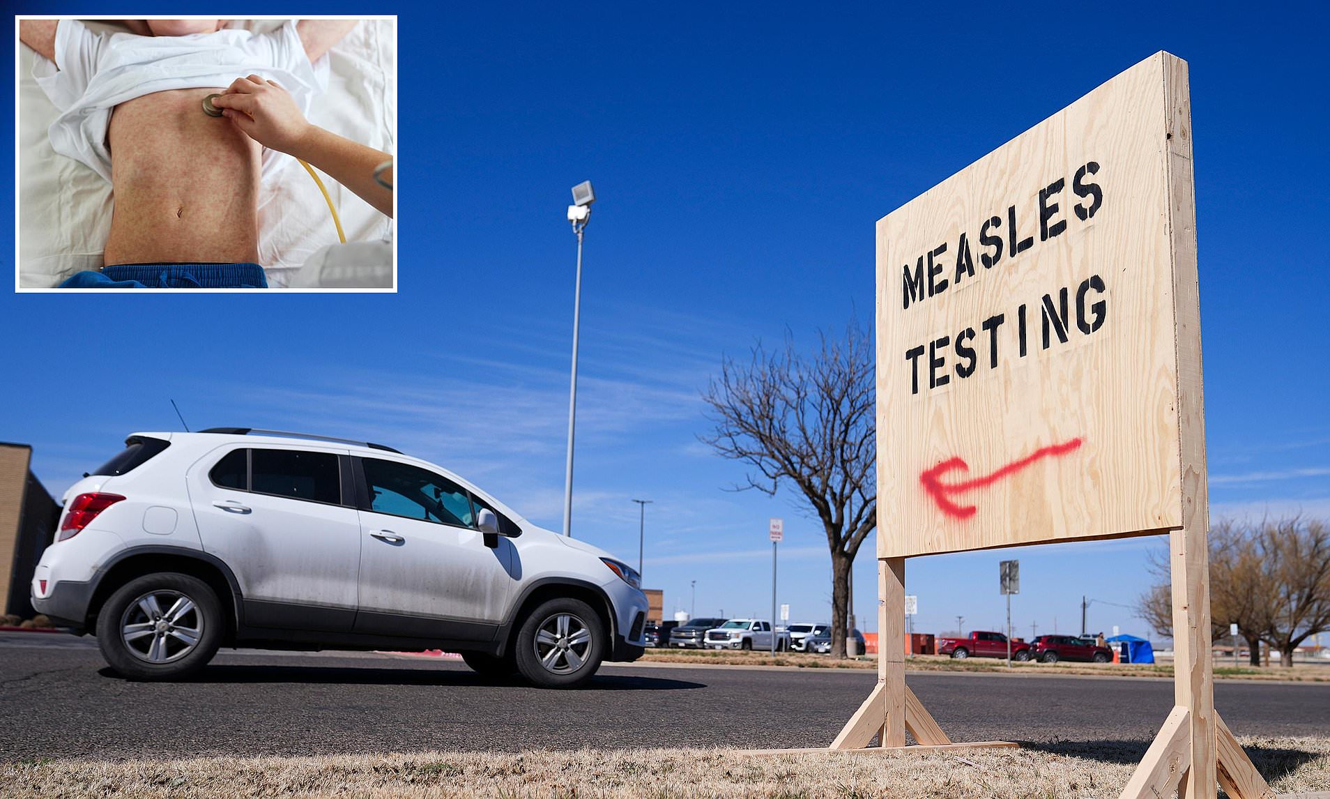 RFK Jr reveals two children have died from measles in Texas