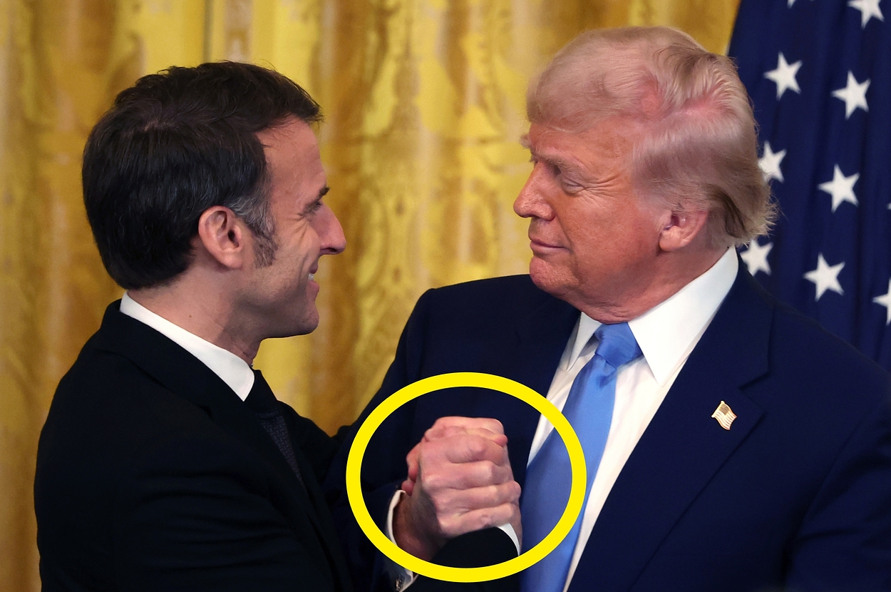 Here's What The White House Said About The Huge Bruise On Trump's Hand