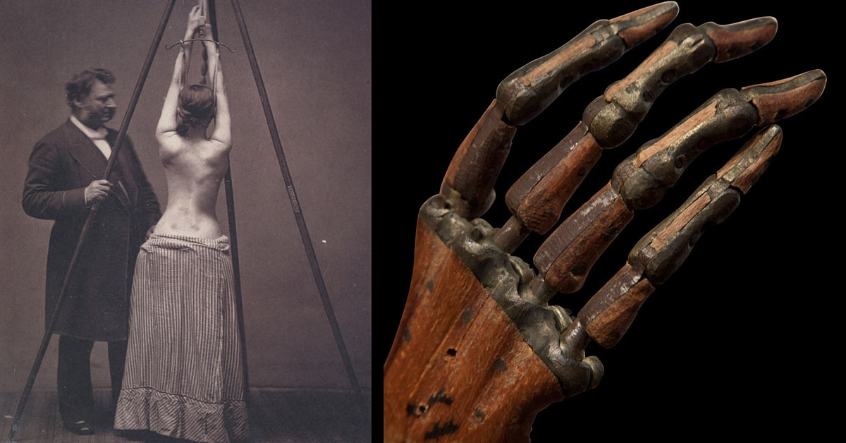 27 Vintage Photos That Show The Terrifying Medical Procedures and ...