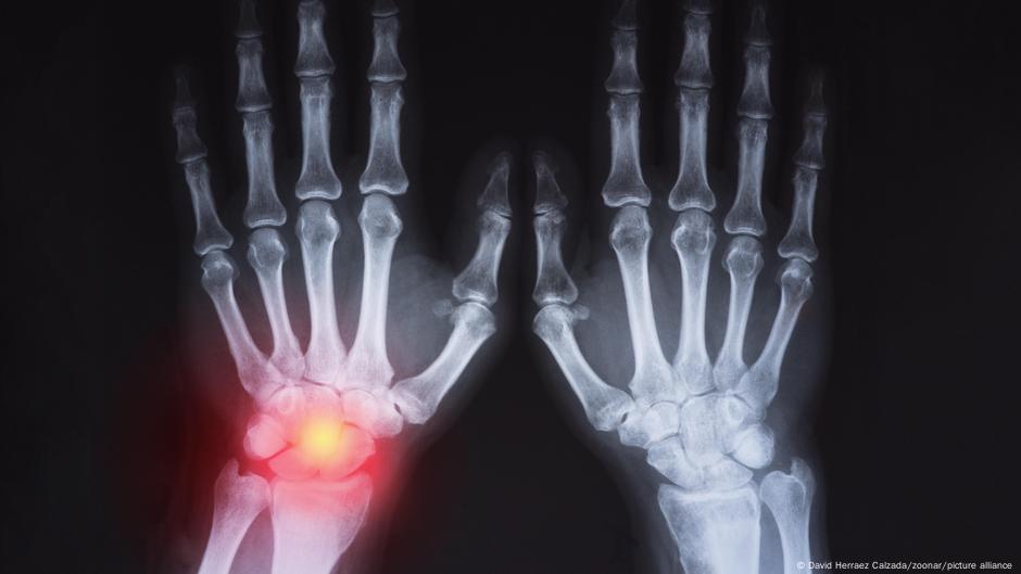 How do our joints work?