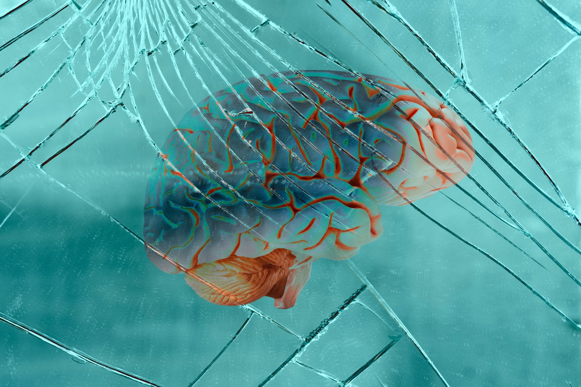 AI-Powered Forensic Tool Predicts Traumatic Brain Injuries with 94% ...