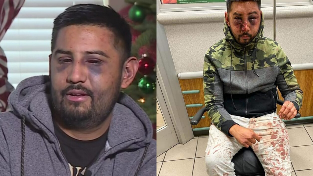 Stockton man who claimed he was beaten in racist attack by jail guards ...