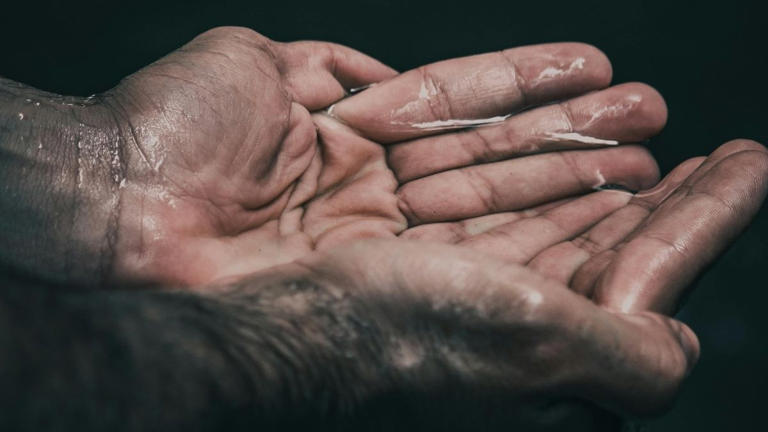 6 Most Common Causes of Hand Tremors