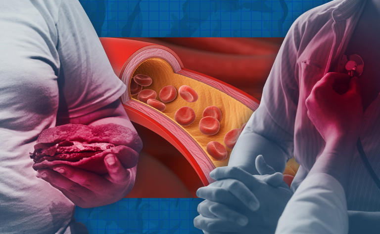 High bad cholesterol: The silent threat, how to fight it