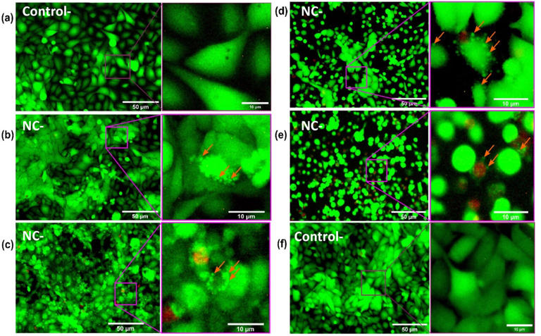 Aged biomass emissions could pose greater risk to lungs than fresh ...