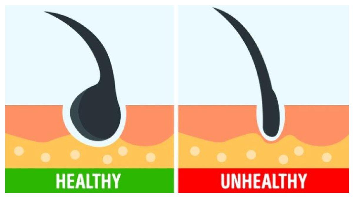 4 Cara Mengetahui Kesehatan Rambut Anda