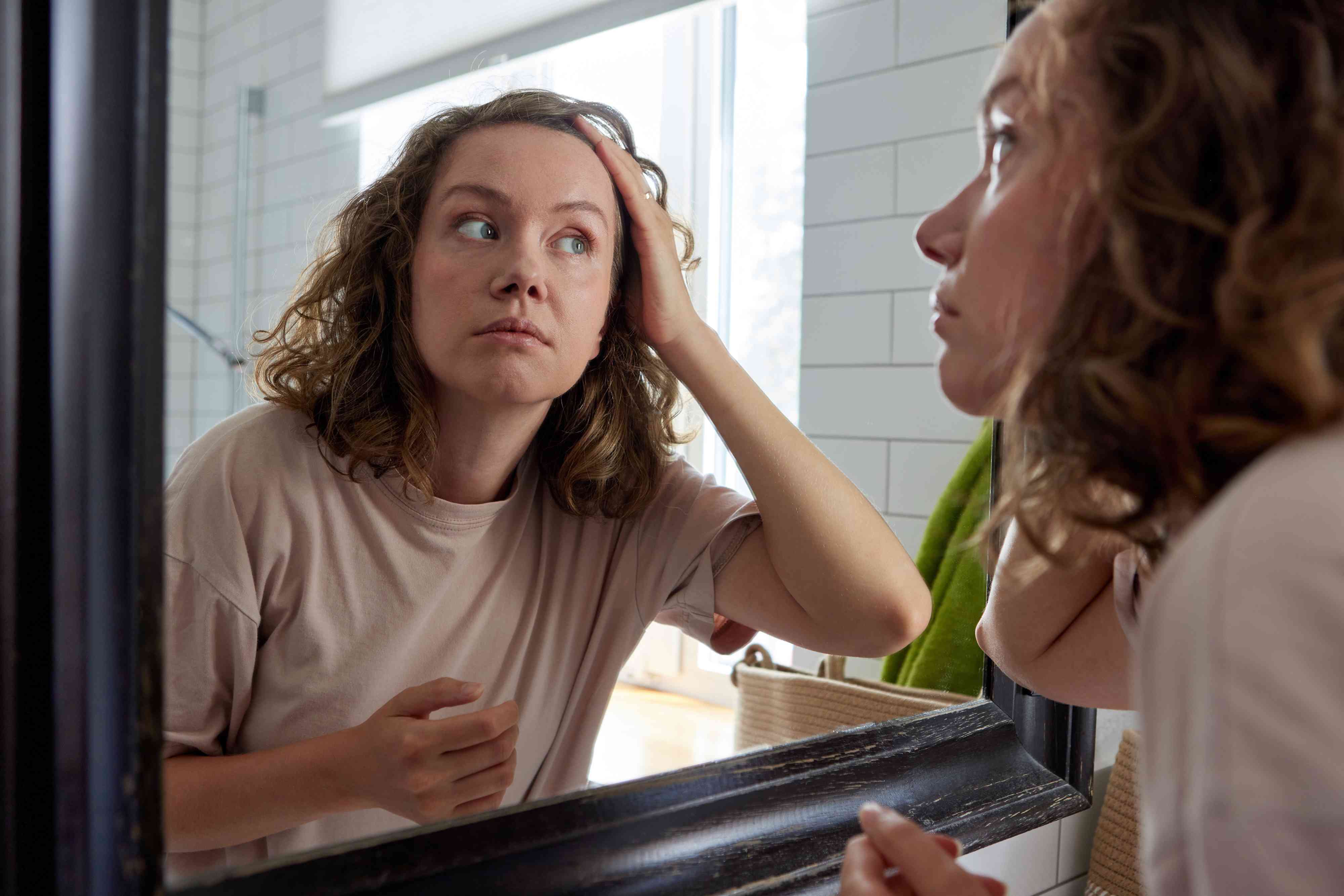 How to tell if you may have scalp psoriasis vs. dandruff