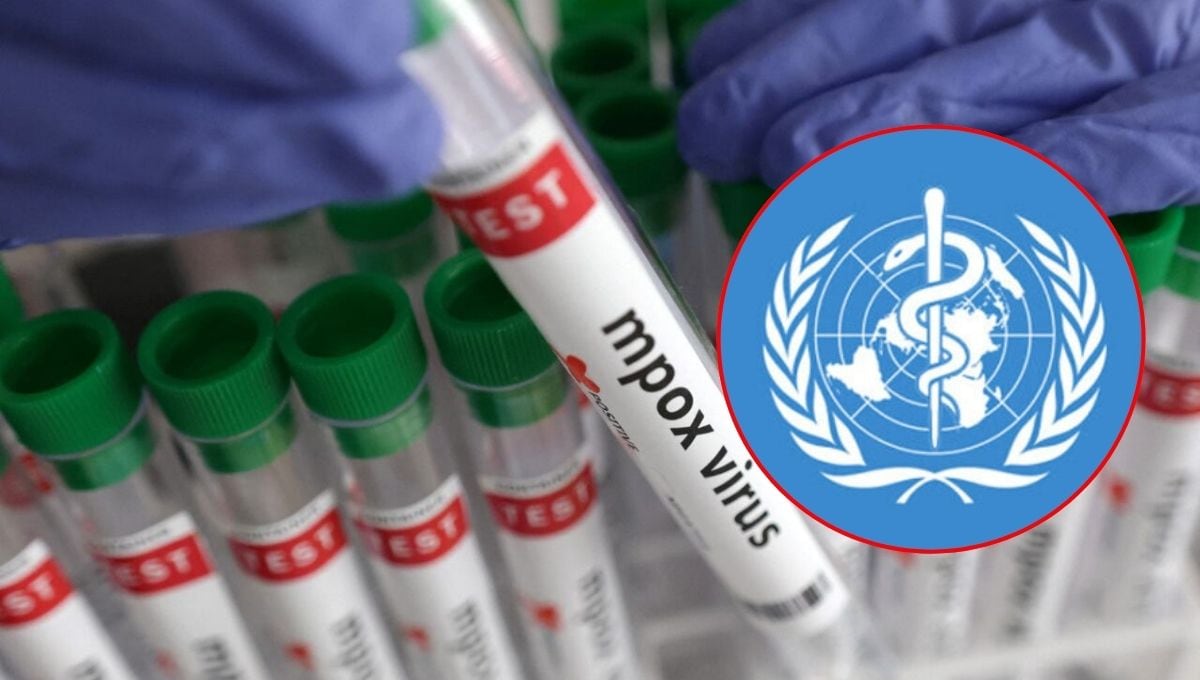 OMS solicita apoyo urgente para enfrentar brote global de mpox (viruela del mono)