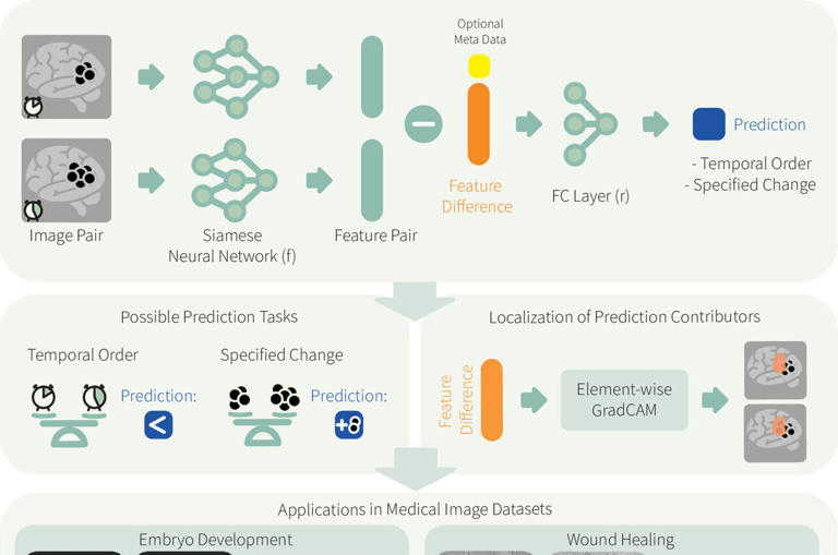 Versatile AI system can detect subtle changes in series of medical images