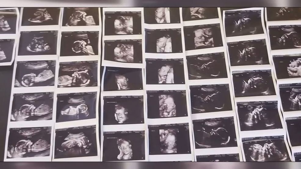 How DC plans to combat high maternal mortality rates among women of color