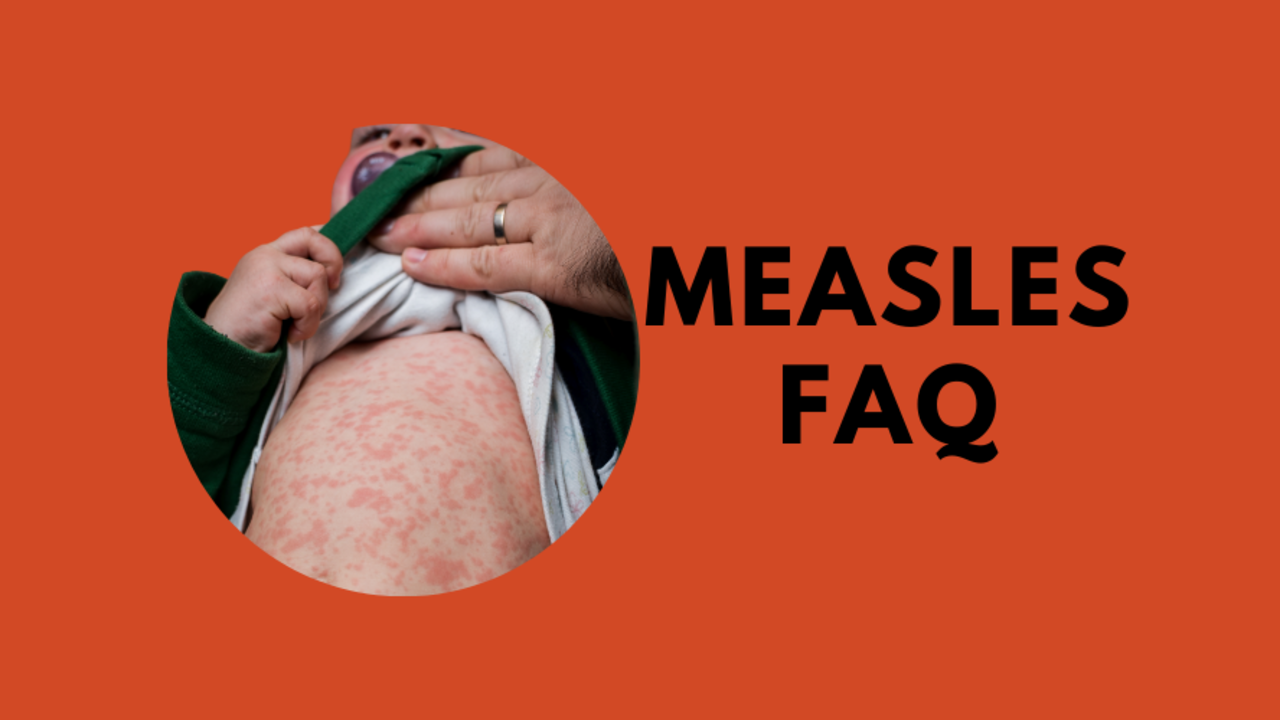 Measles FAQs: What You Must Know About The Disease