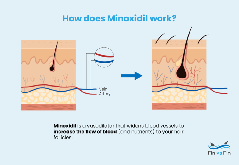 Manual Hair Loss Review – Does It Work for Male Pattern Baldness?