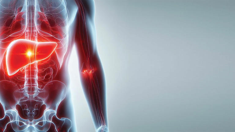 Liver disease | The hidden danger