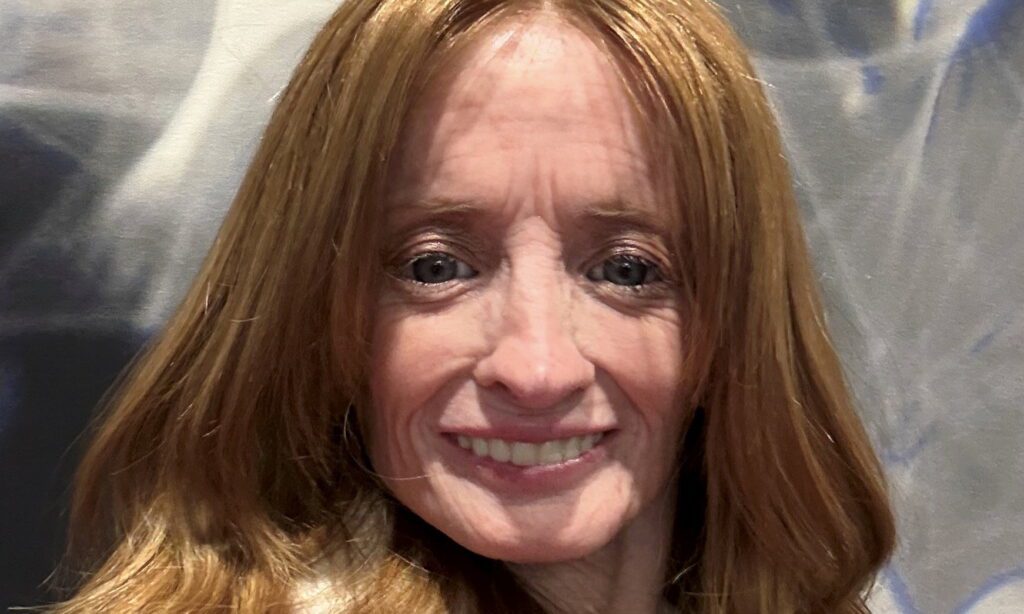 “I have one-in-a-million disease and age 10 times faster but ageing is ...