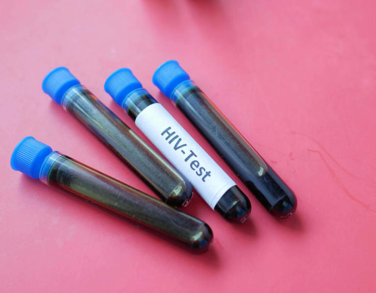 MinSalud incorpora medicamentos antirretrovirales para el tratamiento ...