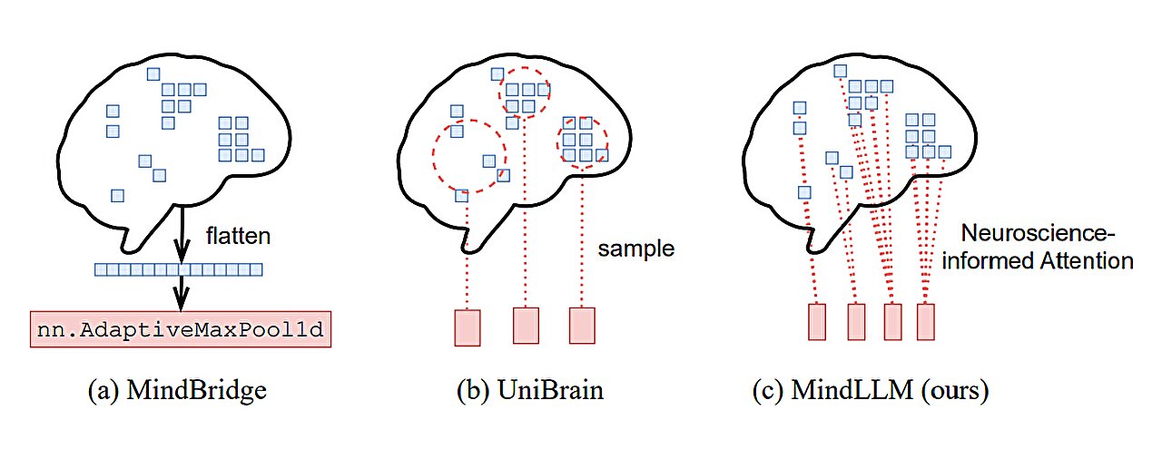 Direct translation of brain imaging to text with MindLLM