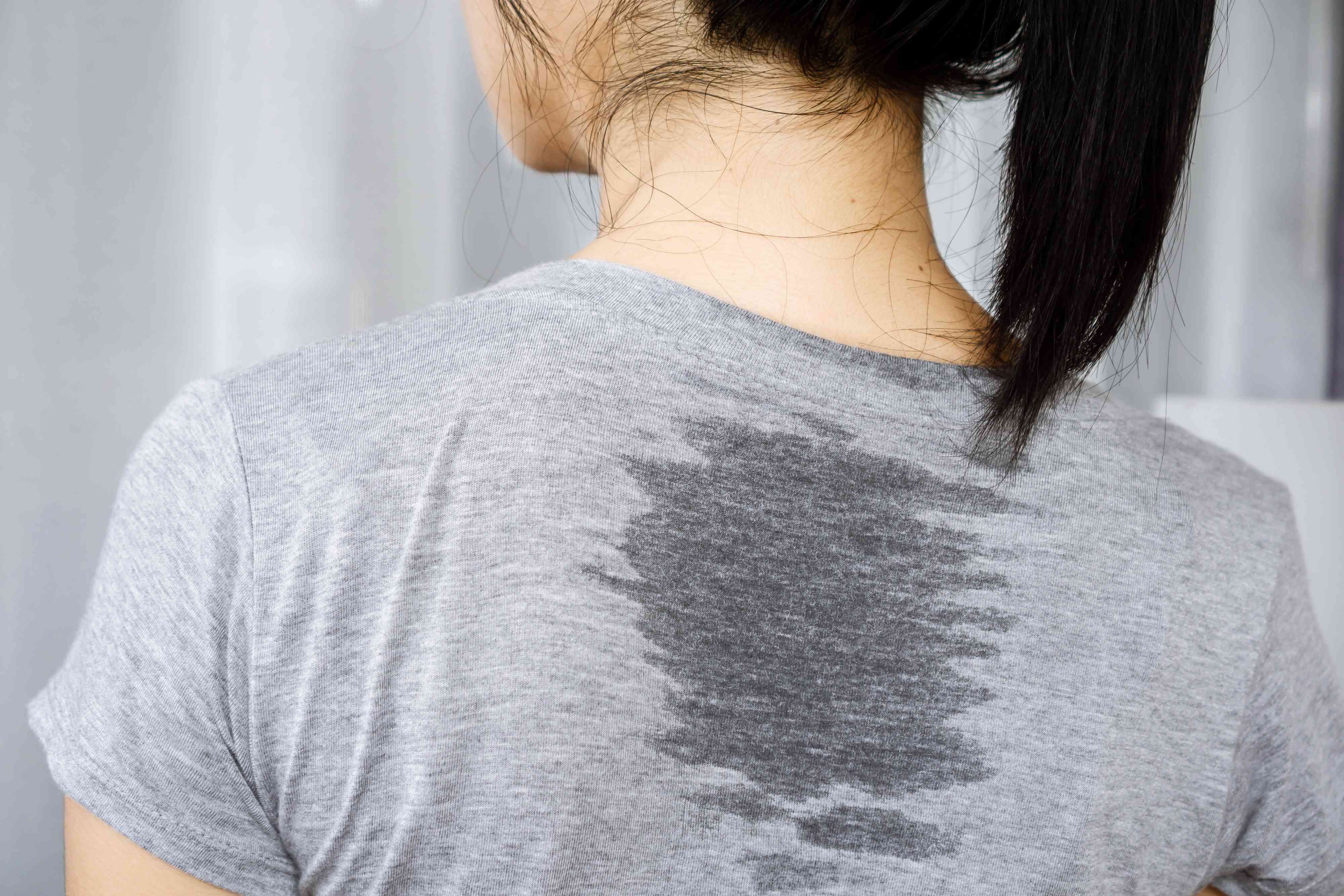 What are the hyperhidrosis treatment options?