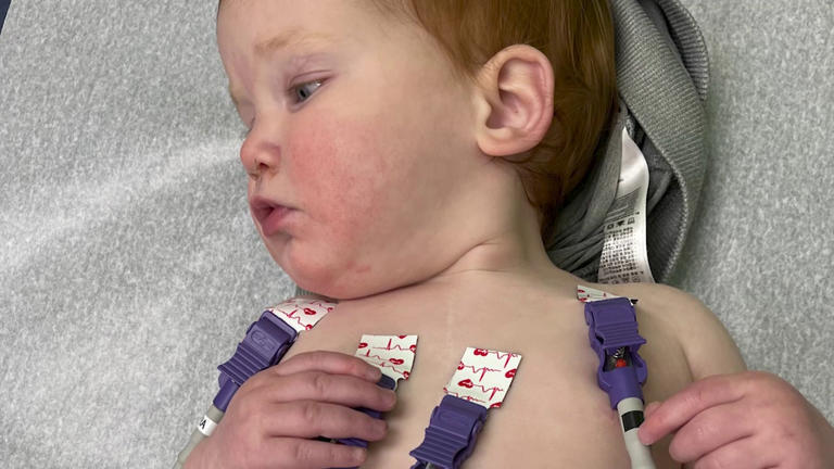 ‘Pretty magnificent’: Child born with multiple heart defects defying ...