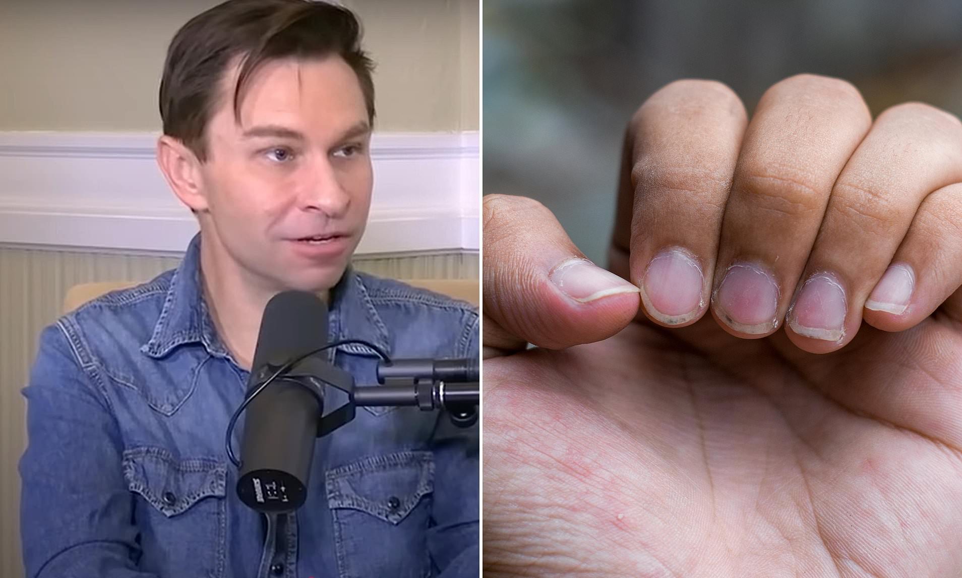 Expert reveals the fingernail sign that tells you how long you'll live