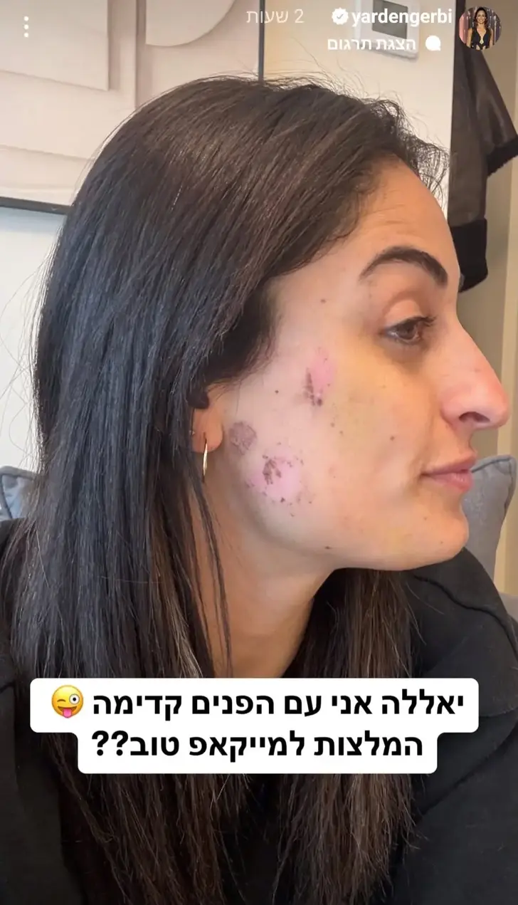 MSN Israel | מבזקי חדשות בישראל ובעולם, ספורט, כלכלה, סלבס וסרטונים שווים