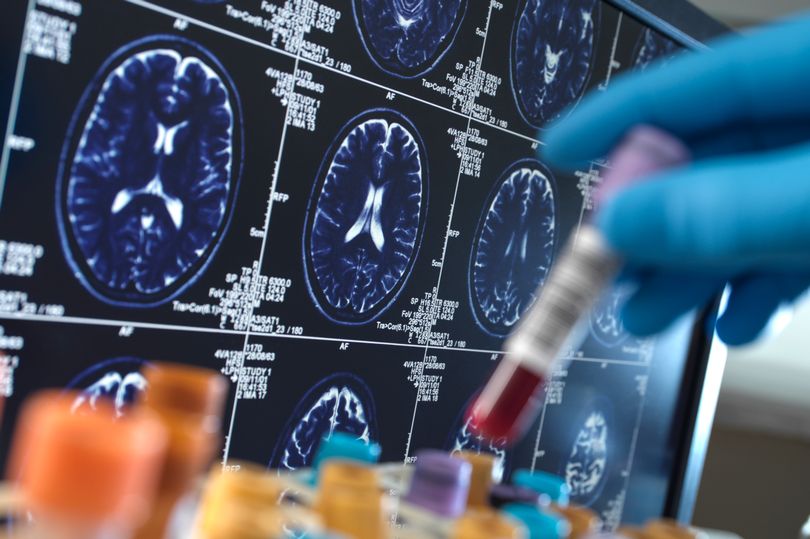 Overlooked injury may 'double' dementia risk in later life