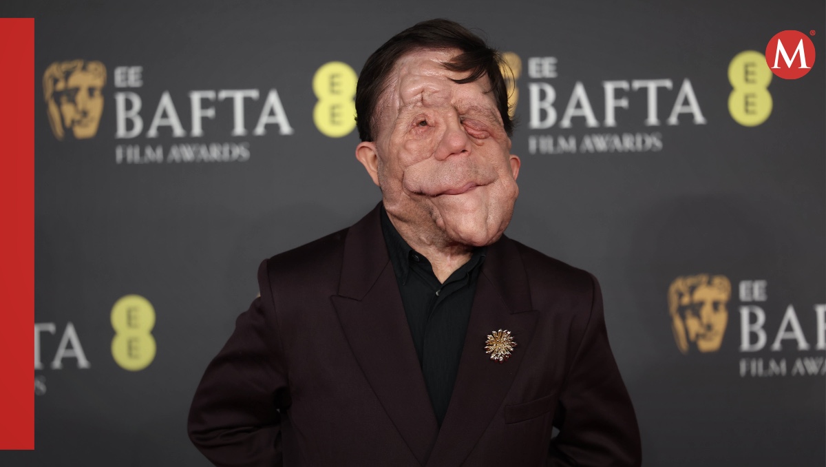Adam Pearson, actor de 'Un hombre diferente', es víctima de ...