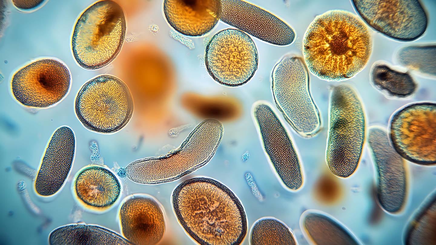 Recce Pharma exceeds expectations in antibiotic skin gel trial