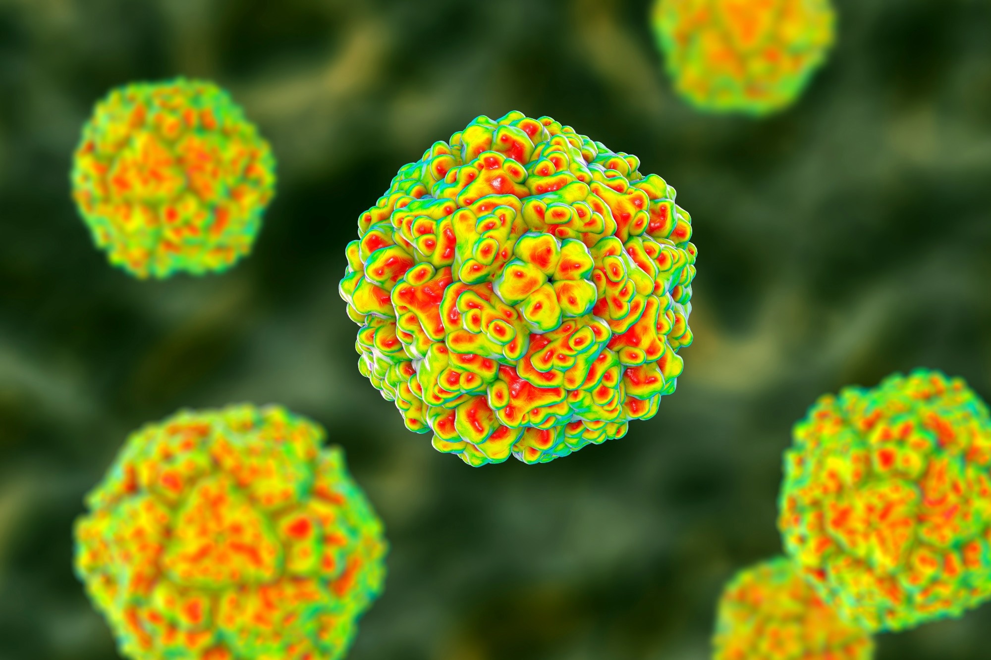 Rare enterovirus strain in Spain raises alarms over potential outbreaks