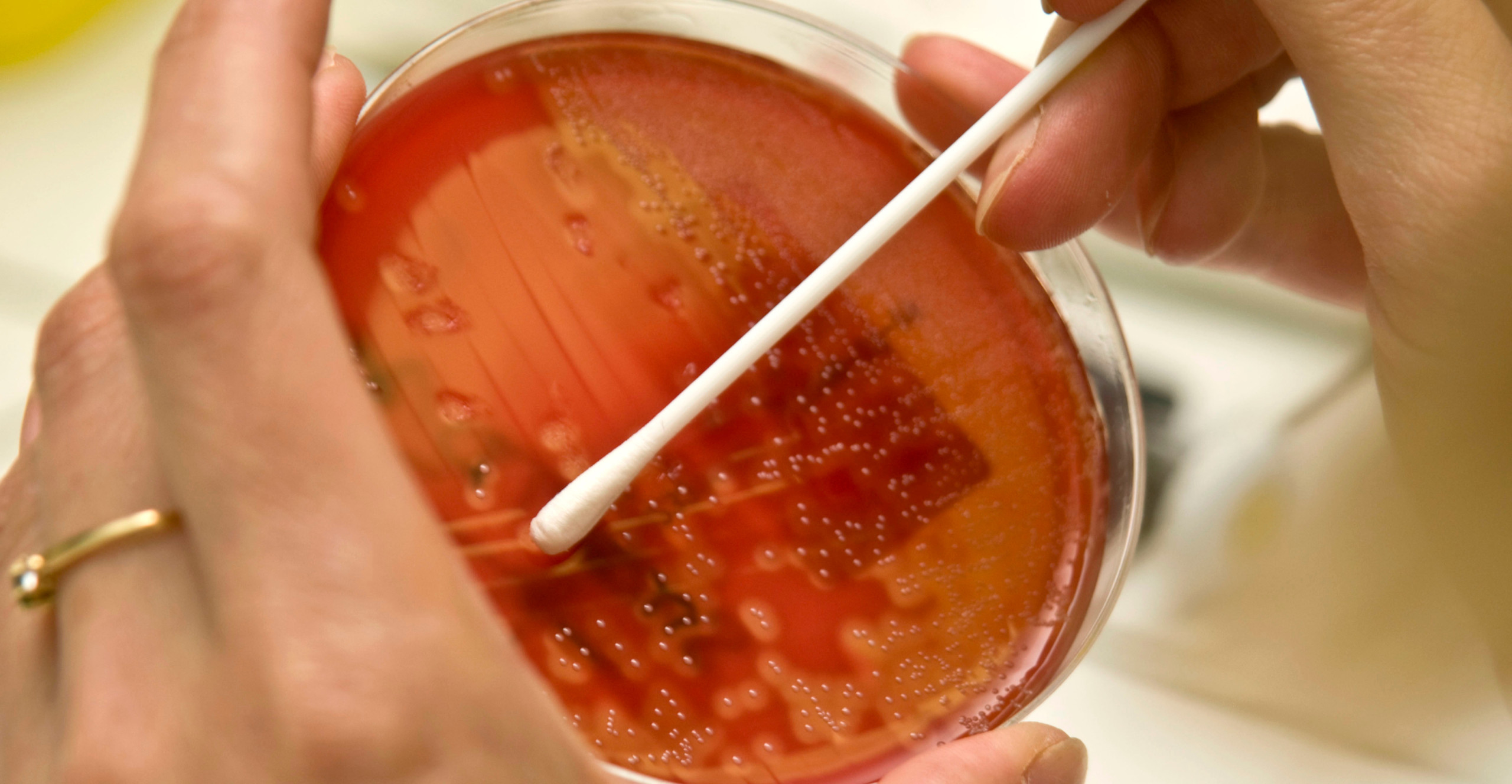 The harmful bacteria that can exist in the human body