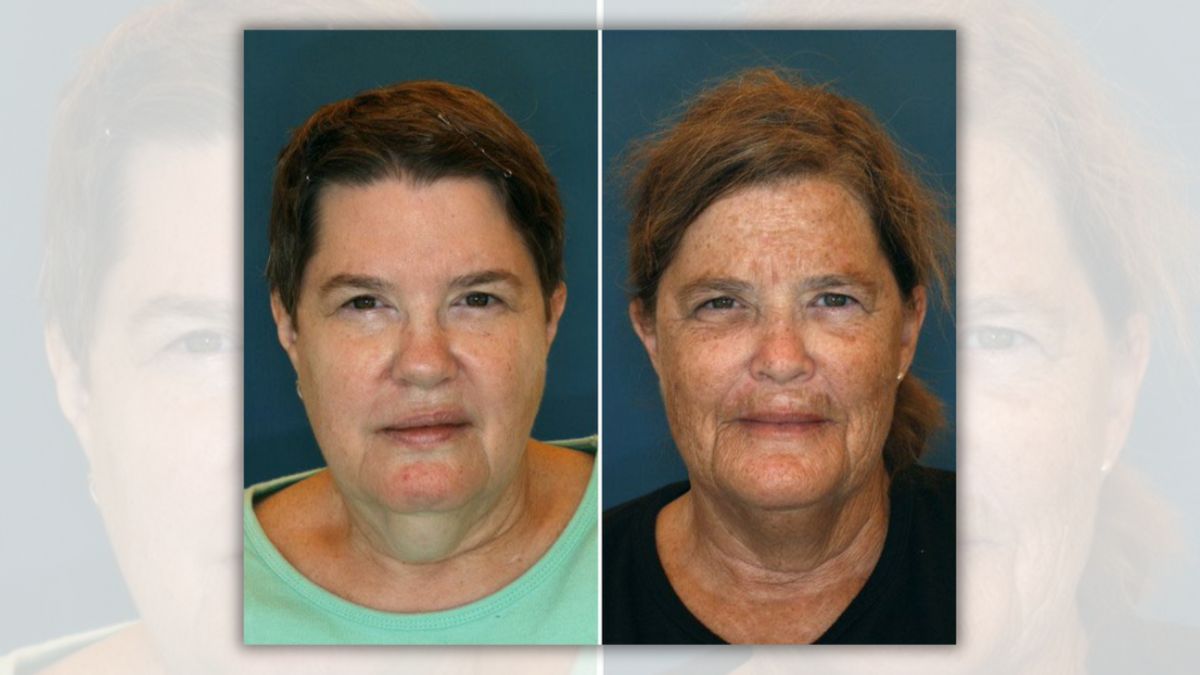 Photos showing 'effects of sun exposure and smoking' on identical twins ...