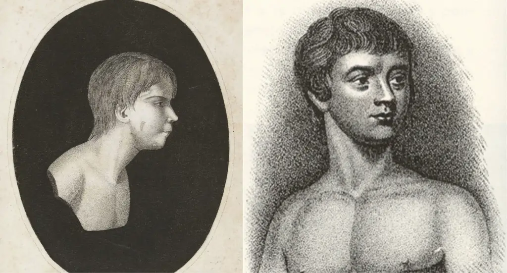 18 Strange Cases of Humans Raised by Animals