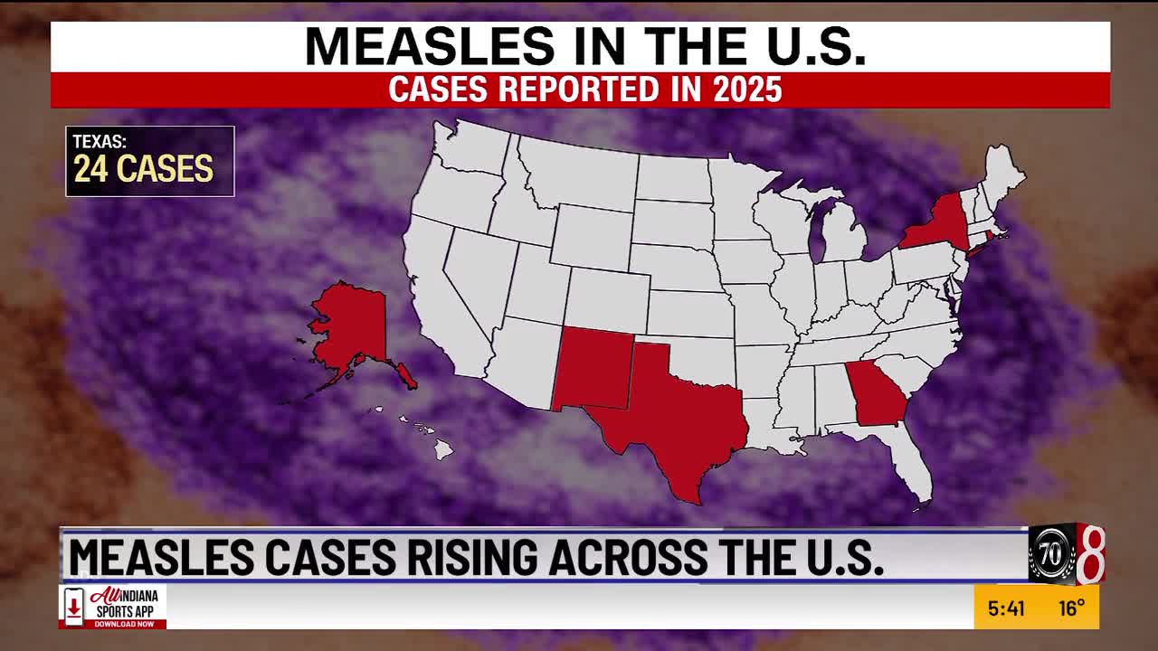 Measles cases rising across the U.S.