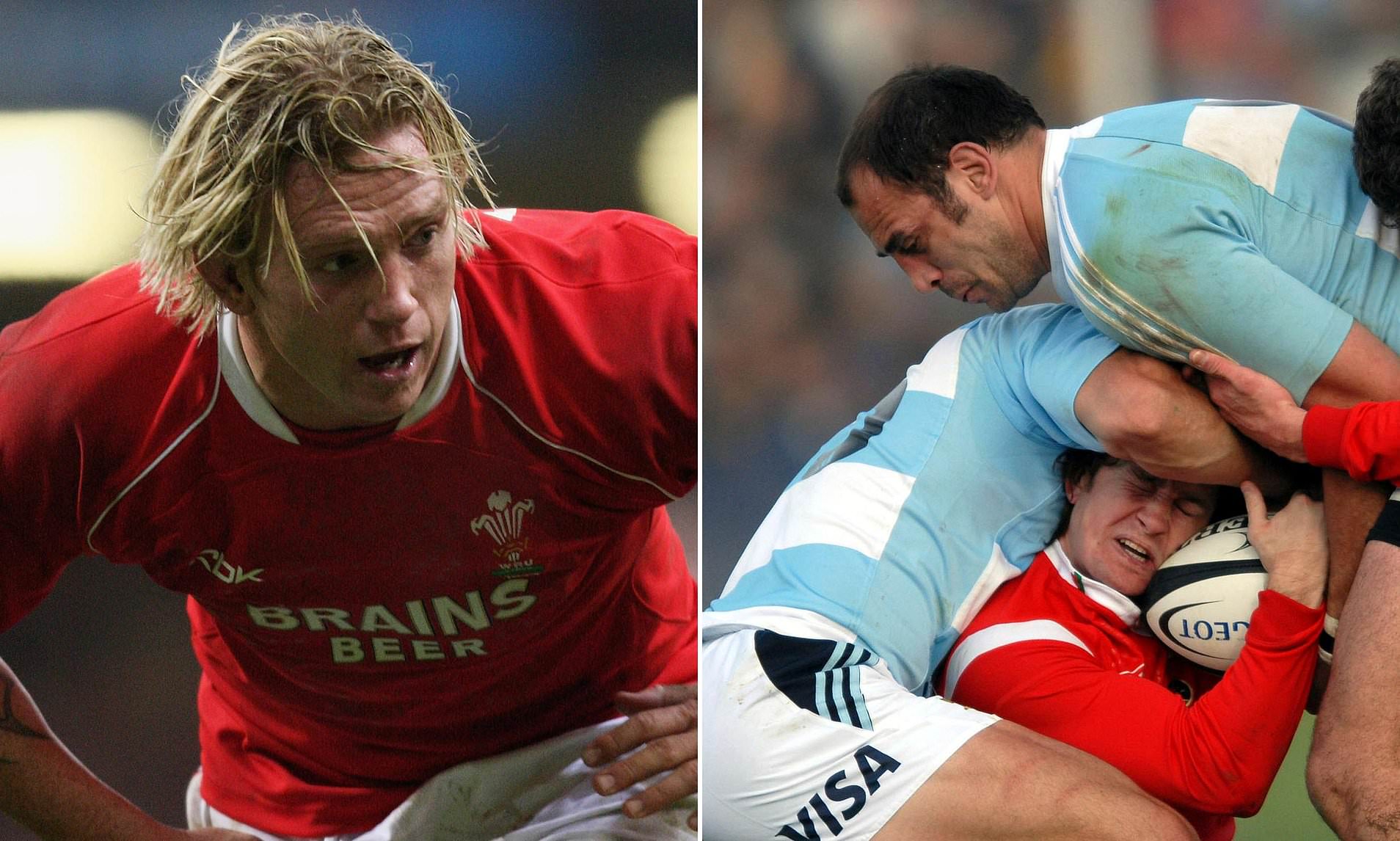Former Wales rugby star says he has 'no recollection' of his career due ...