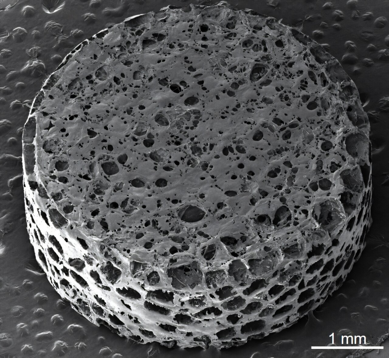 Multiple sclerosis: Cell-catching implant helps identify successful ...