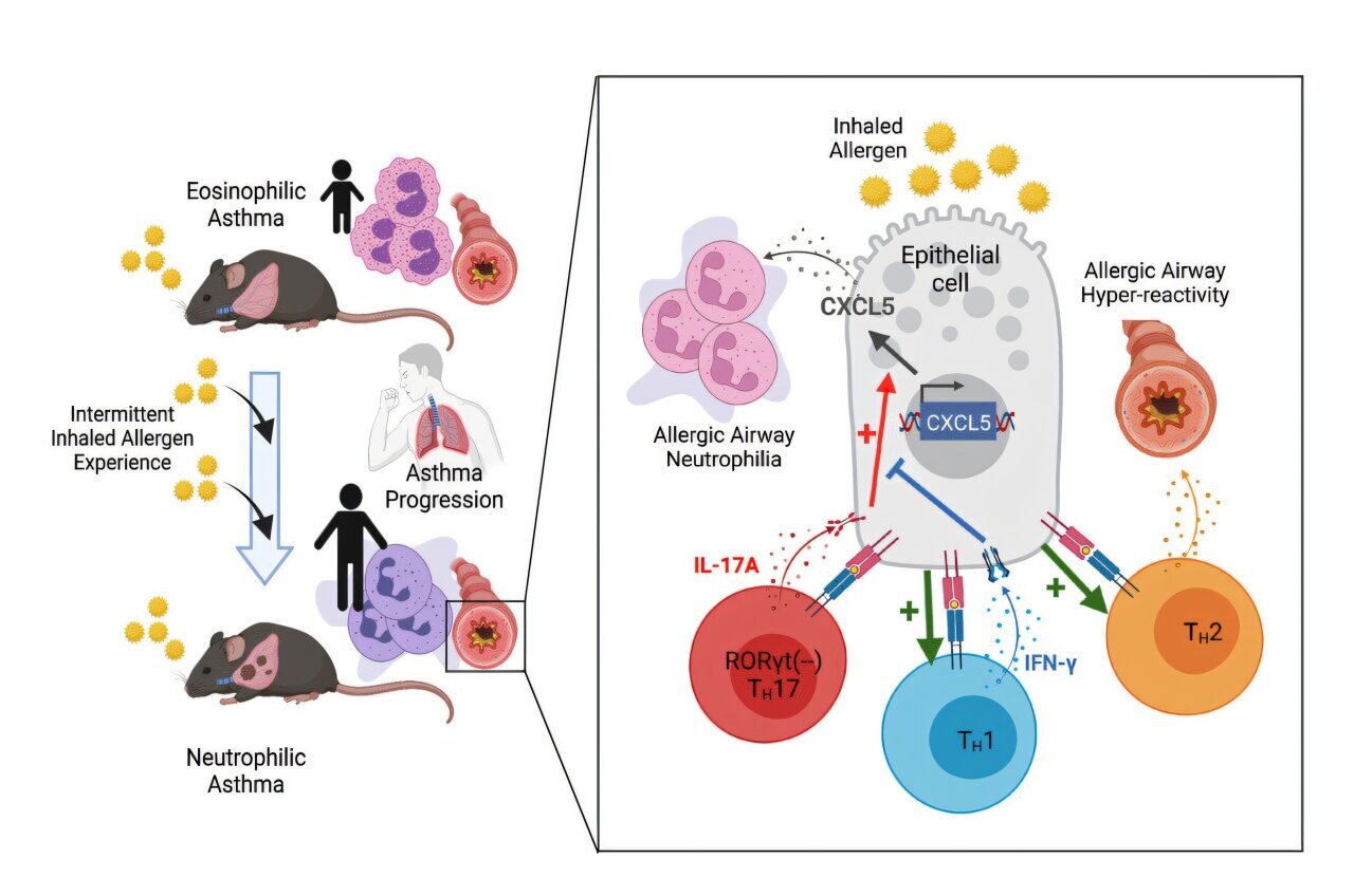 Mouse model uncovers how lung cells manage severe asthma inflammation