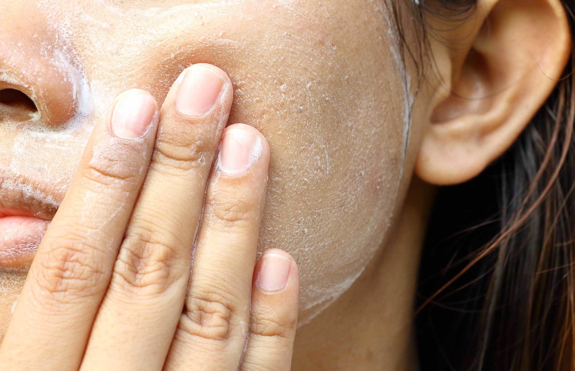 20 signs you have hypersensitive skin