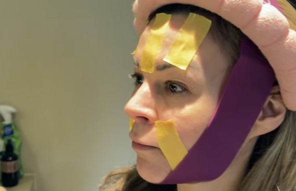 Millennial Skin - MSN