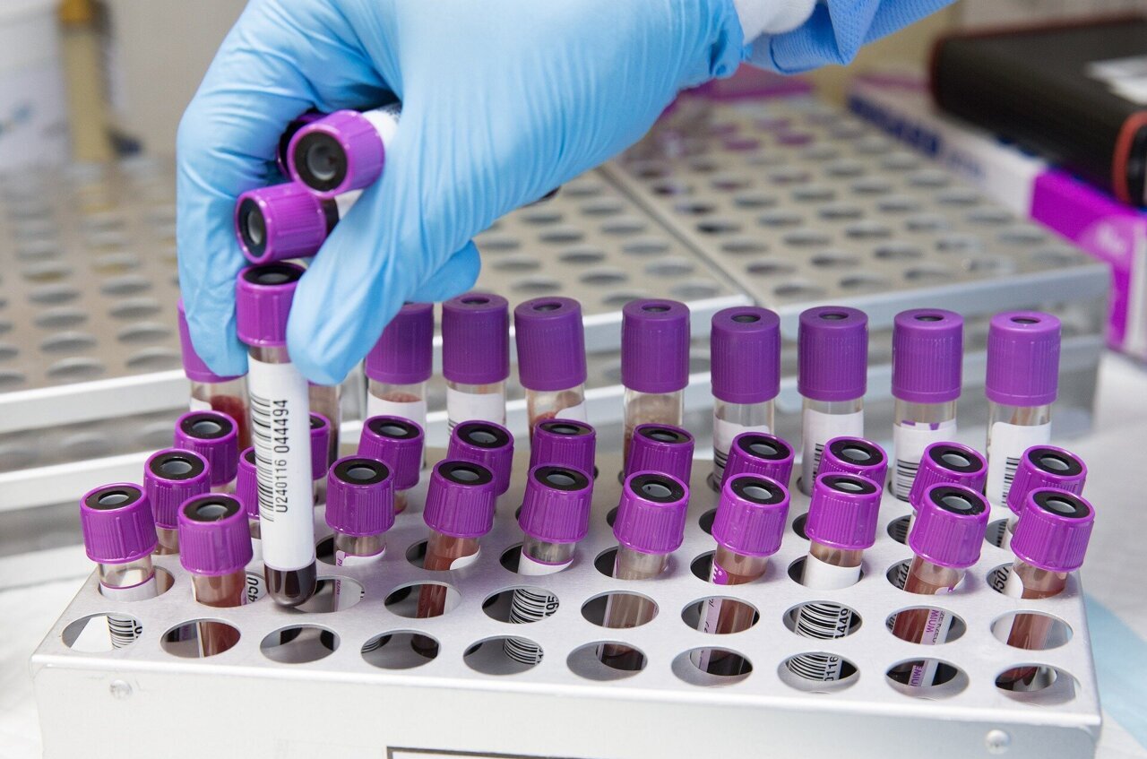 Biobanking on health: Sharing biological samples and data to build a ...