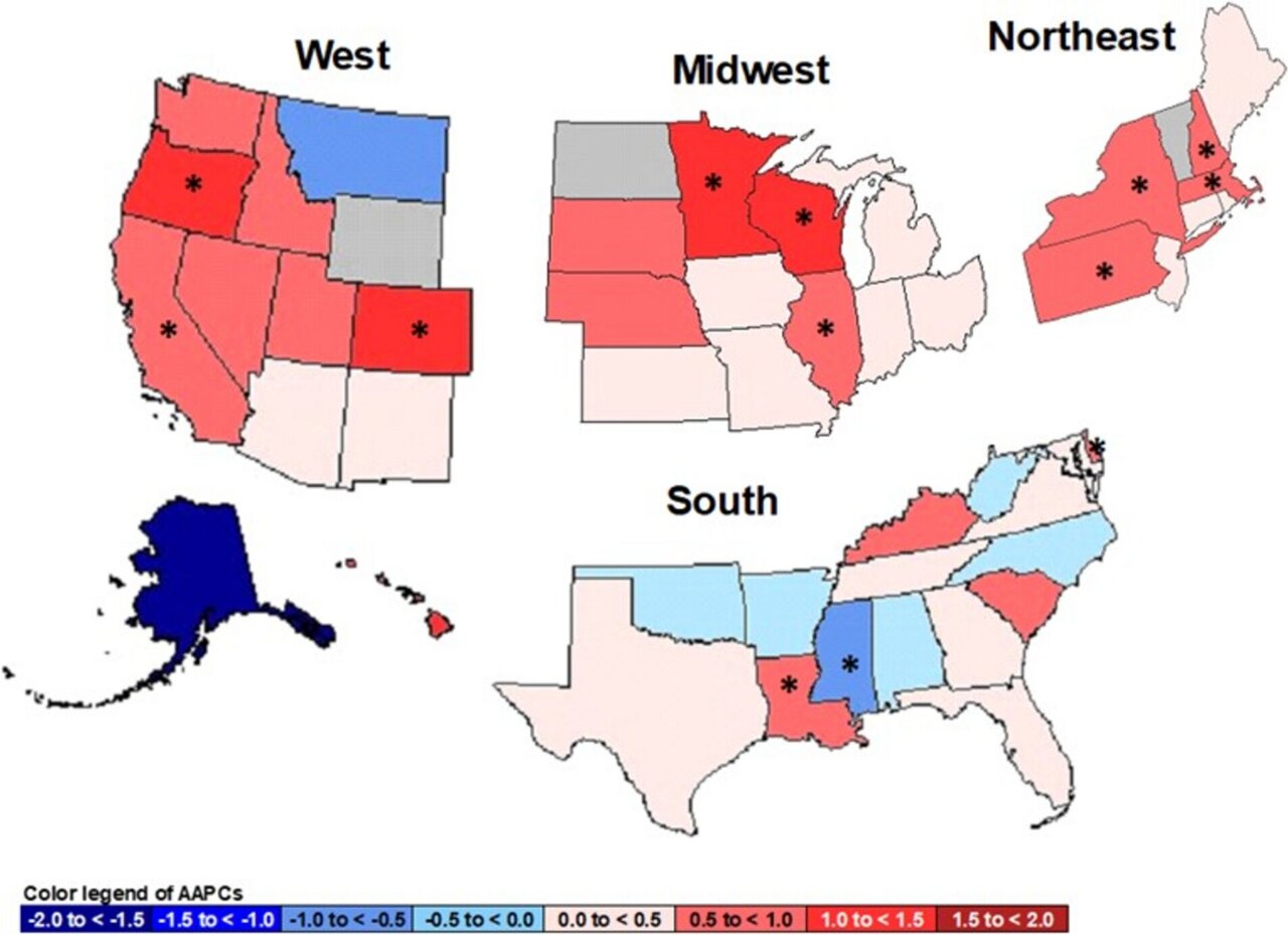 Data from all 50 states show early onset breast cancer is on the rise ...